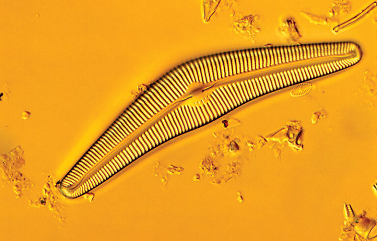 Cymbella Cistula | Estuary Magazine: For people who care about the ...